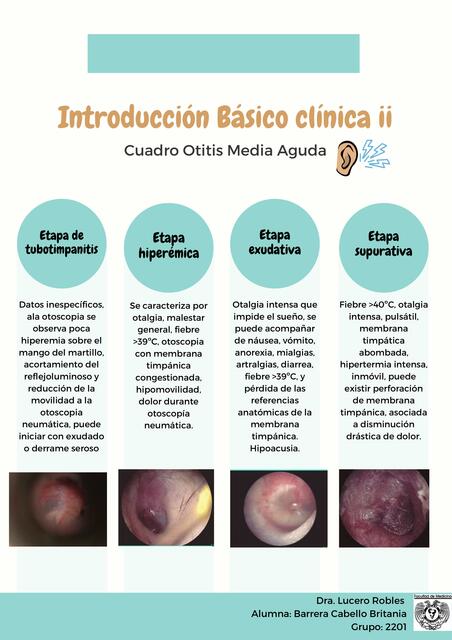 Cuadro Clínico Otitis Media Aguda | IOVANNY CRUZ OJEDA | uDocz