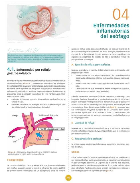 Enfermedades inflamatorias del esófago | Full ciencia | uDocz