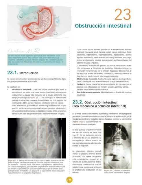 Obstrucción intestinal | Full ciencia | uDocz