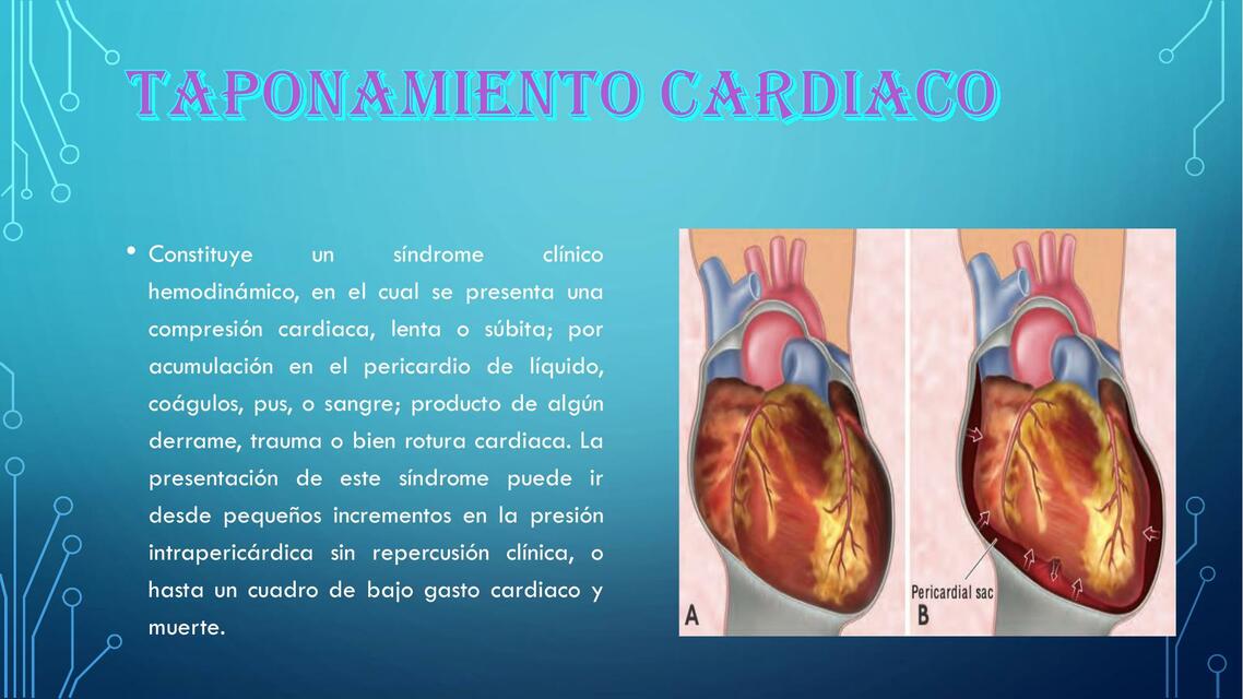 6 Taponamiento cardiaco | Aida NursNotes | uDocz