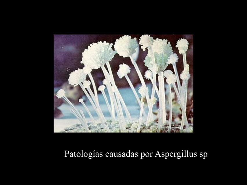 Aspergilosis | IOVANNY CRUZ OJEDA | uDocz