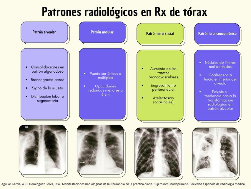 Patrones radiológicos en Rx de tórax | Iván Ayala Collado | uDocz
