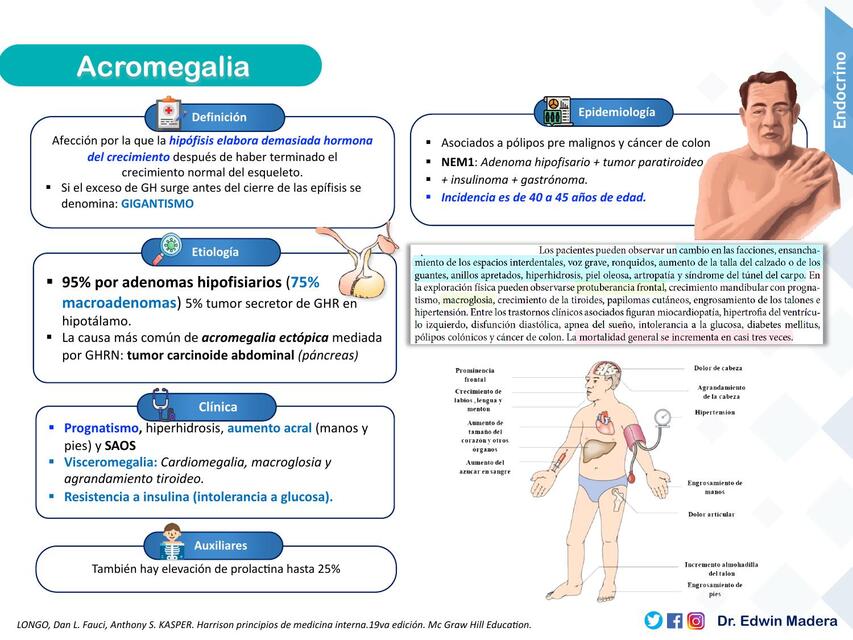 Acromegalia | Alan Gustavo Arellano Ramos | uDocz