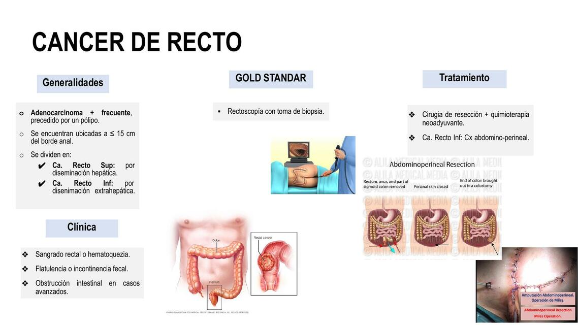 Cáncer de recto | @CUIDADO.MEDICO | uDocz