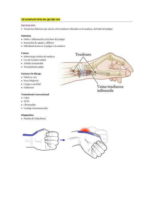 Tenosinovitis de quervain | Physio Studies | uDocz