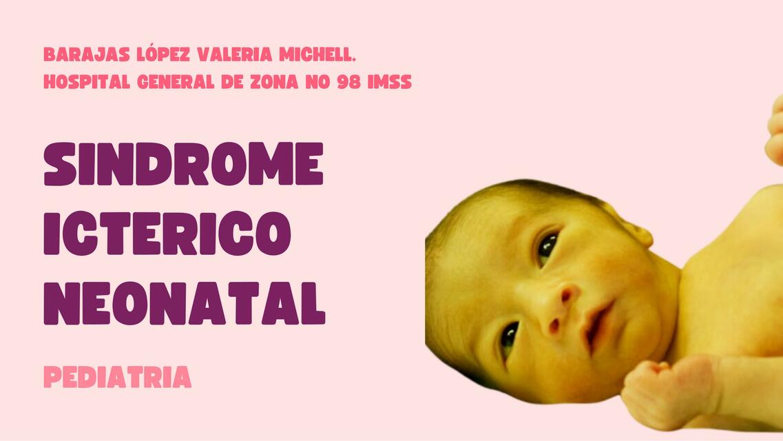 Síndrome icterico neonatal | Valeria Michell Barajas | uDocz