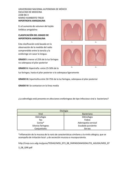 Hipertrofia amigdalina | IOVANNY CRUZ OJEDA | uDocz