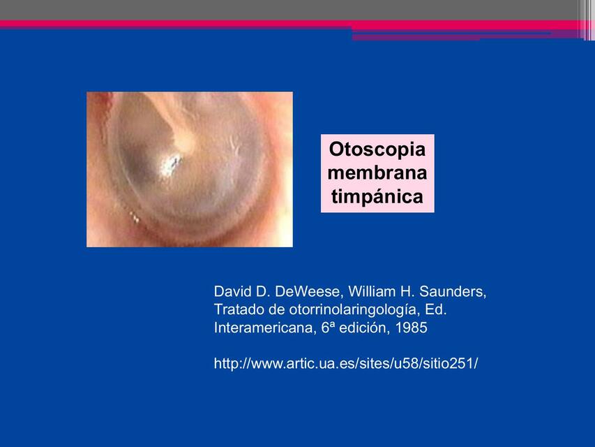Hallazgos clínicos a la otoscopia membrana timpánica | IOVANNY CRUZ ...