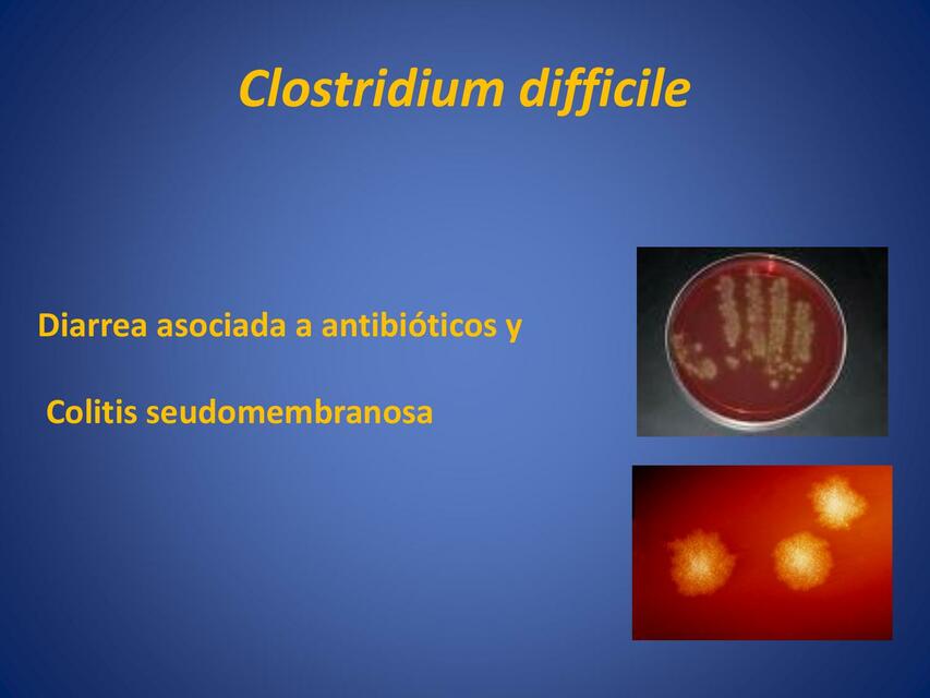 Clostridium Difficile | IOVANNY CRUZ OJEDA | uDocz