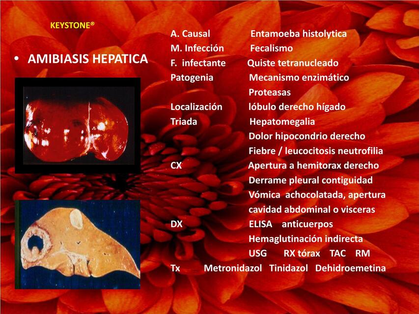 Amebiasis hepática | IOVANNY CRUZ OJEDA | uDocz