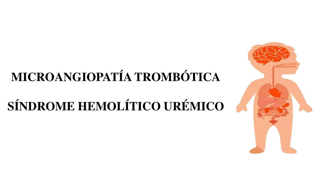 Microangiopatía Trombótica | Antonella Sarango Ramos | uDocz