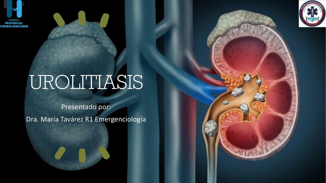 Urolitiasis | Mariatavarez28@hotmail.com | uDocz