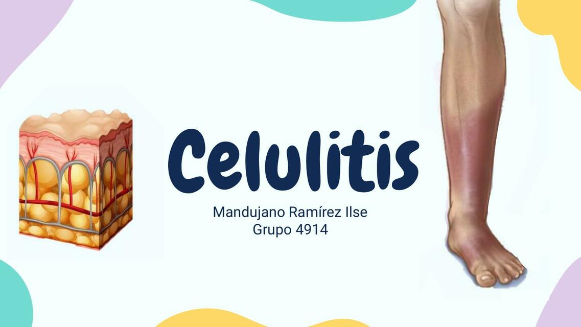 Celulitis | Jessy González | uDocz