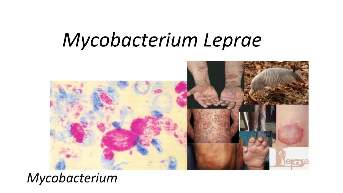 Mycobacterium Leprae clase | IOVANNY CRUZ OJEDA | uDocz