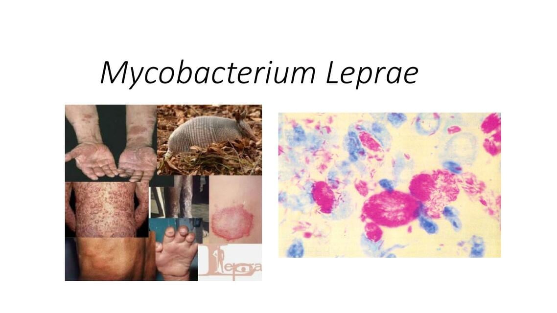 Mycobacterium Leprae clase | IOVANNY CRUZ OJEDA | uDocz