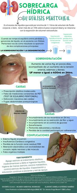 Sobrecarga Hídrica en Diálisis Peritoneal | Danita Zerimar | uDocz