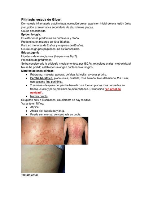 Resúmenes de Pitiriasis rosada | Descarga apuntes de Pitiriasis rosada