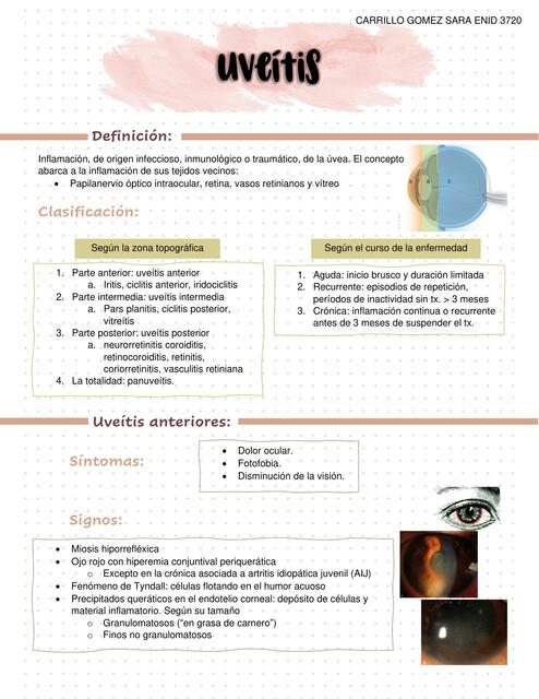 Resumen uveitis | IOVANNY CRUZ OJEDA | uDocz