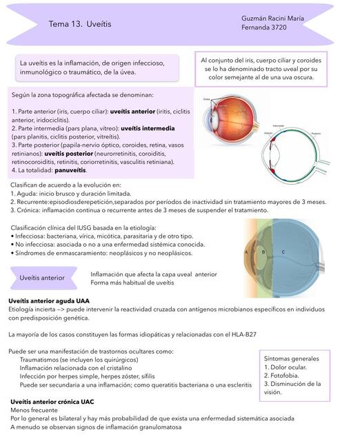 Resumen uveitis | IOVANNY CRUZ OJEDA | uDocz