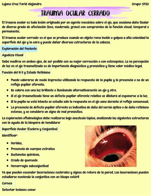 Trauma ocular cerrado y quemaduras oculares resumen | IOVANNY CRUZ ...