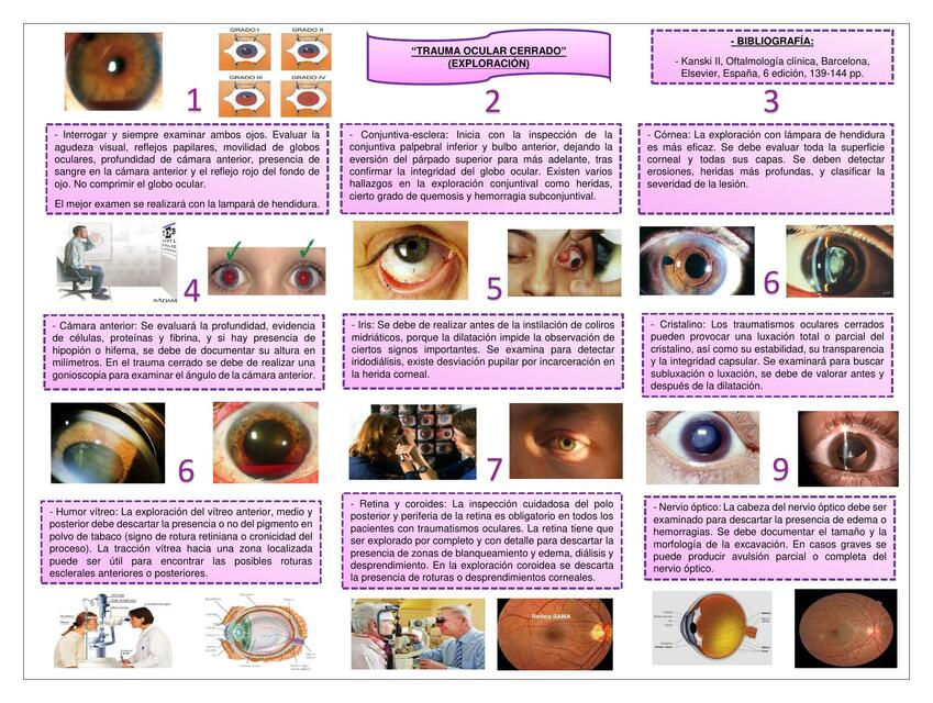 Trauma ocular cerrado y quemaduras oculares resumen | IOVANNY CRUZ OJEDA | uDocz