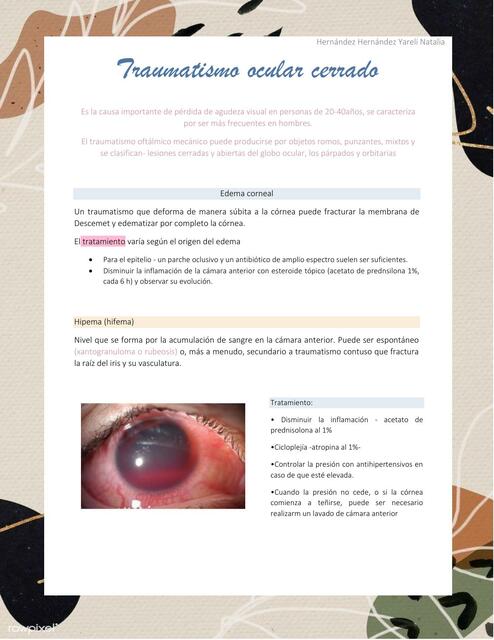 Trauma ocular cerrado y quemaduras oculares resumen | IOVANNY CRUZ ...