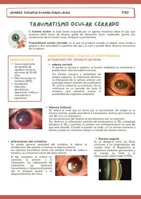 Trauma ocular cerrado y quemaduras oculares resumen | IOVANNY CRUZ OJEDA | uDocz