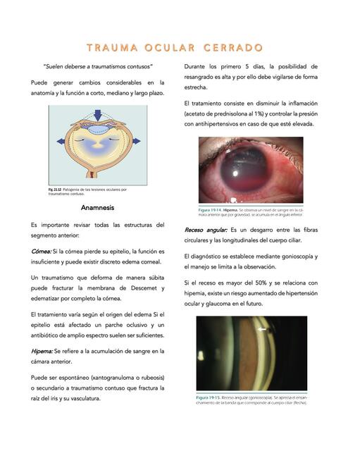 Trauma ocular cerrado y quemaduras oculares resumen | IOVANNY CRUZ ...