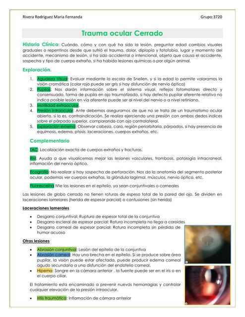 Trauma ocular cerrado y quemaduras oculares resumen | IOVANNY CRUZ OJEDA | uDocz