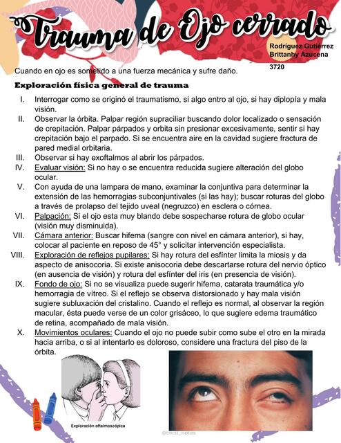 Trauma ocular cerrado y quemaduras oculares resumen | IOVANNY CRUZ ...