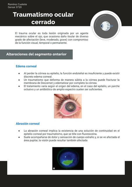 Trauma ocular cerrado y quemaduras oculares resumen | IOVANNY CRUZ OJEDA | uDocz
