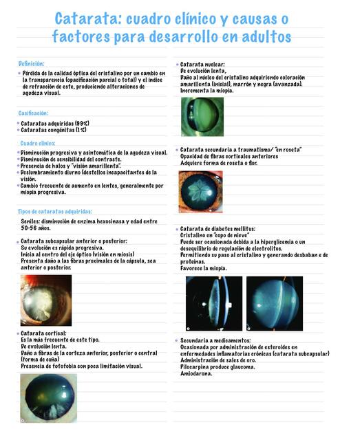 Cataratas cuadro clinico y causas resumen | IOVANNY CRUZ OJEDA | uDocz