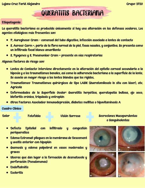 Queratitis bacteriana | IOVANNY CRUZ OJEDA | uDocz
