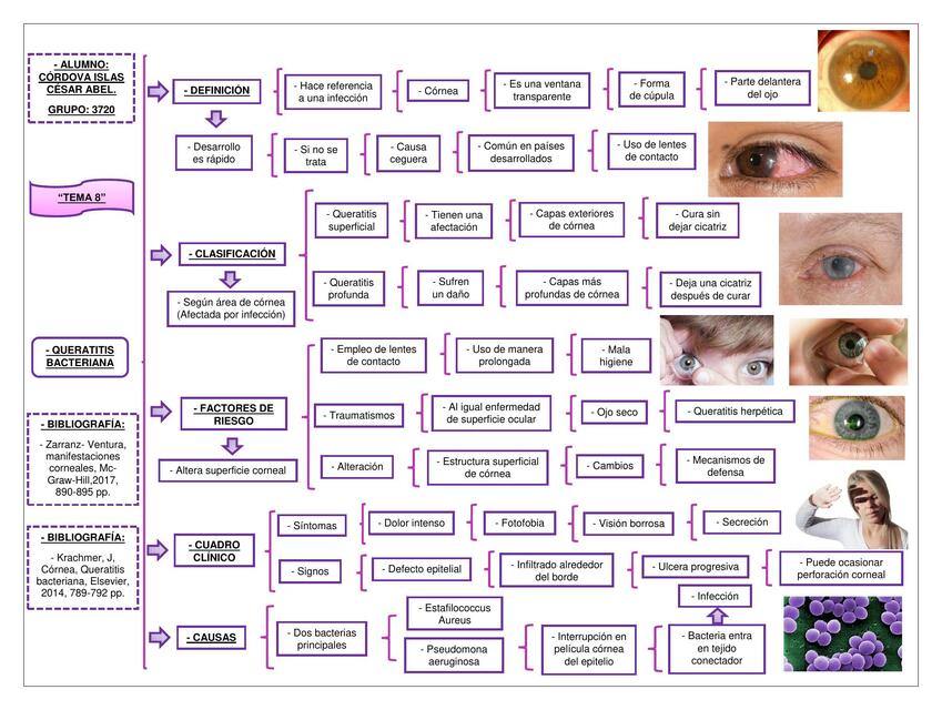 Queratitis bacteriana | IOVANNY CRUZ OJEDA | uDocz
