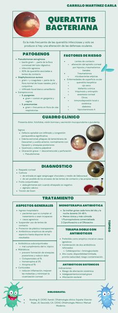 Queratitis bacteriana resumen | IOVANNY CRUZ OJEDA | uDocz