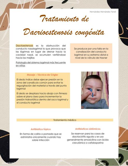 Dacrioestenosis congénita resumen | IOVANNY CRUZ OJEDA | uDocz