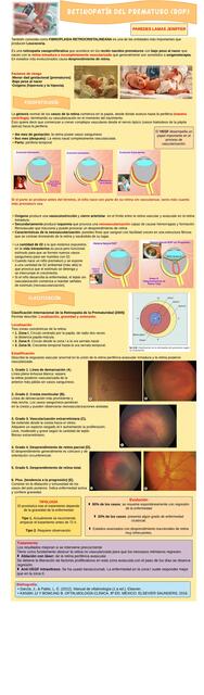 Retinopatía del Prematuro | IOVANNY CRUZ OJEDA | uDocz