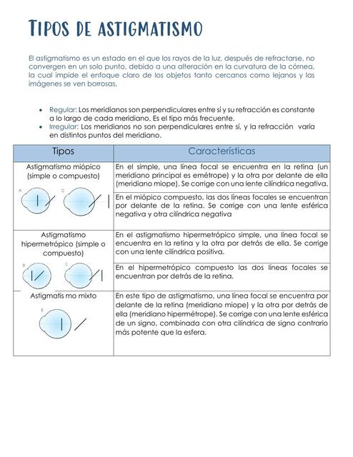 Tipos de astigmatismo | IOVANNY CRUZ OJEDA | uDocz