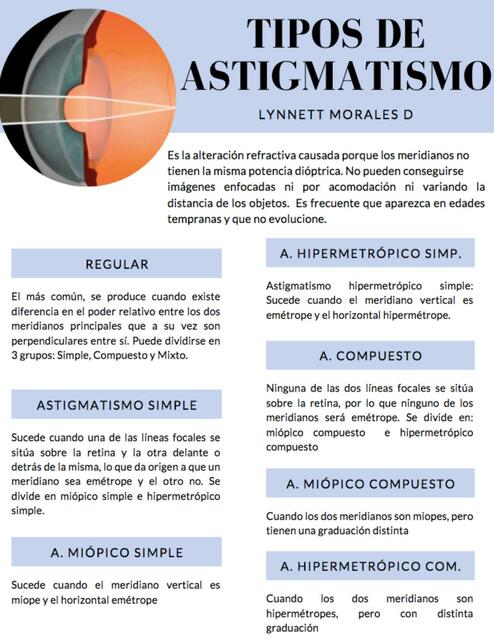 Tipos de astigmatismo | IOVANNY CRUZ OJEDA | uDocz