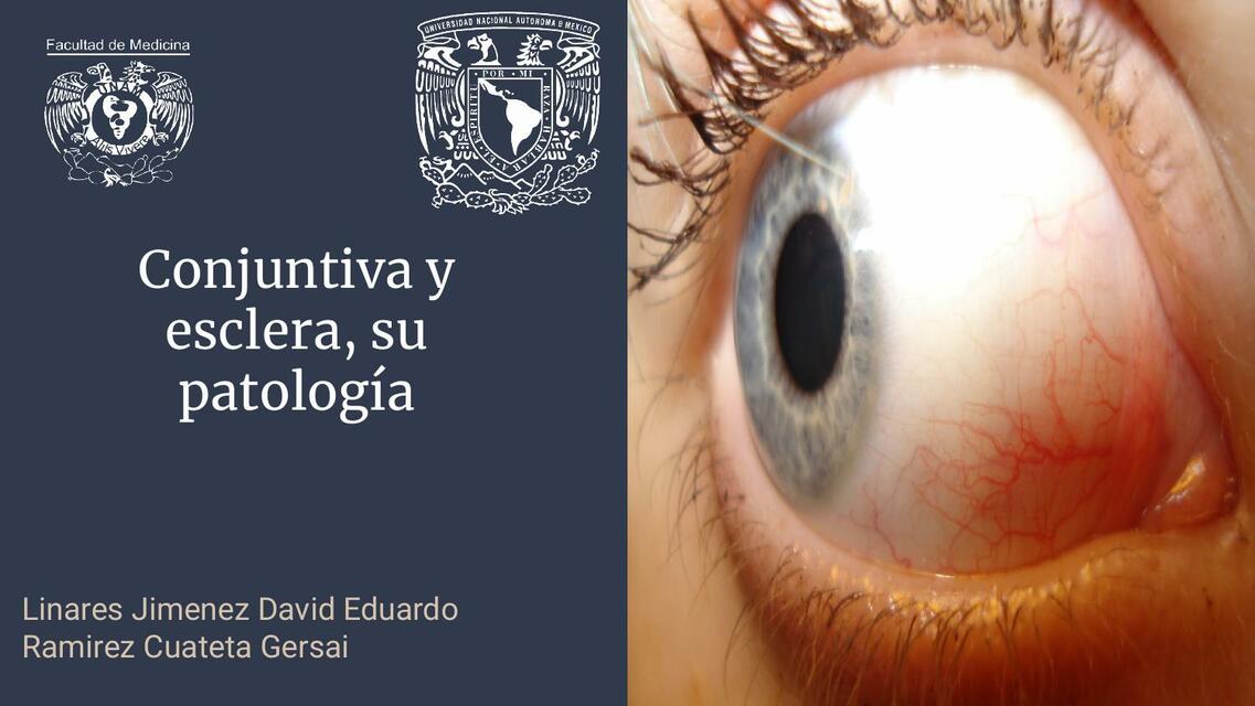 Conjuntiva y esclera patologías | IOVANNY CRUZ OJEDA | uDocz