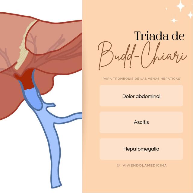 Triada de Budd-Chiari | Viviendo la medicina | uDocz