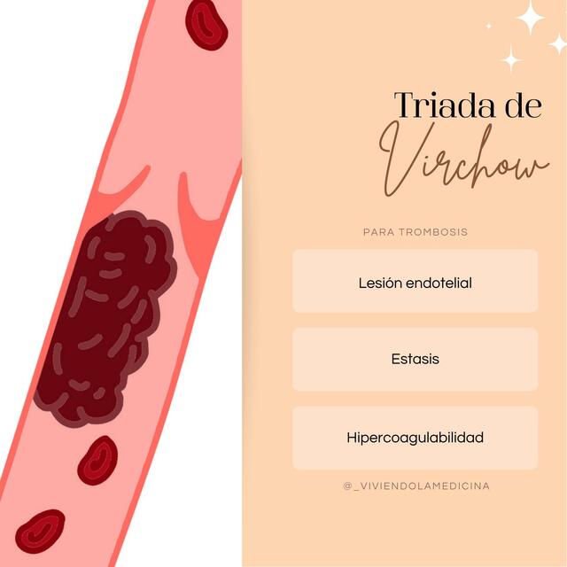 Triada de Virchow | Viviendo la medicina | uDocz