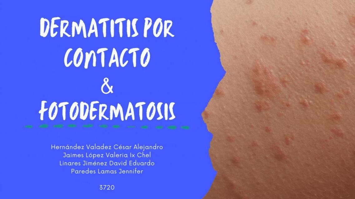 Dermatitis por contacto y Fotodermatosis | IOVANNY CRUZ OJEDA | uDocz