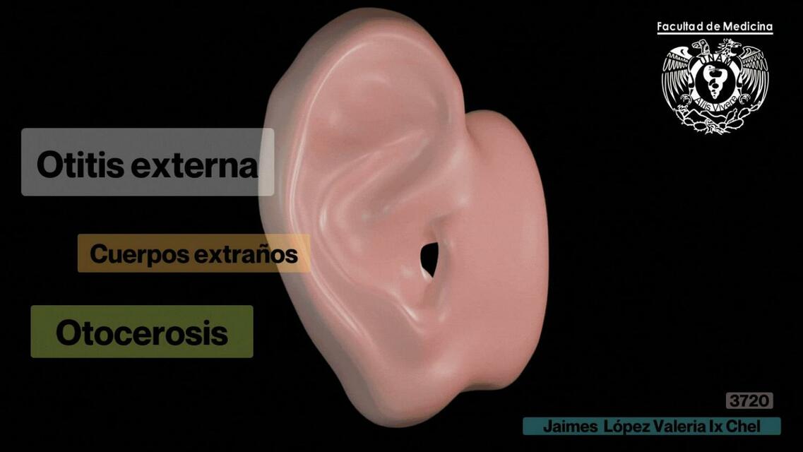 Otitis externa, cuerpos extraños y otocerosis | IOVANNY CRUZ OJEDA | uDocz