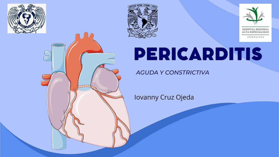 Pericarditis aguda y constrictiva | IOVANNY CRUZ OJEDA | uDocz