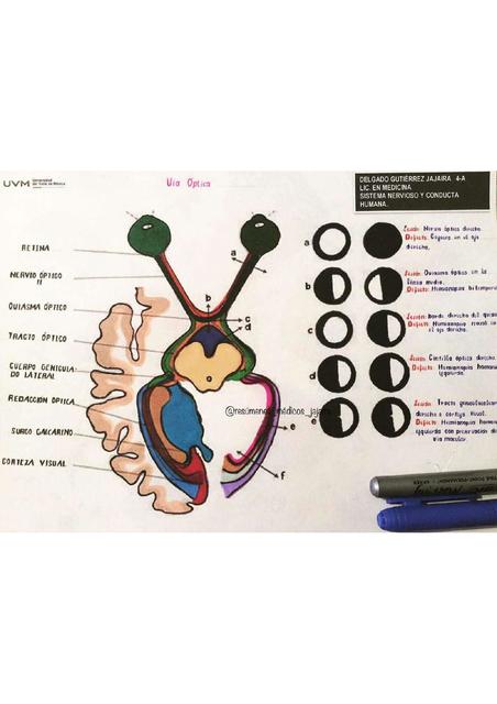 Vía óptica (Oftalmología). | Jajaira Delgado Gutiérrez | uDocz
