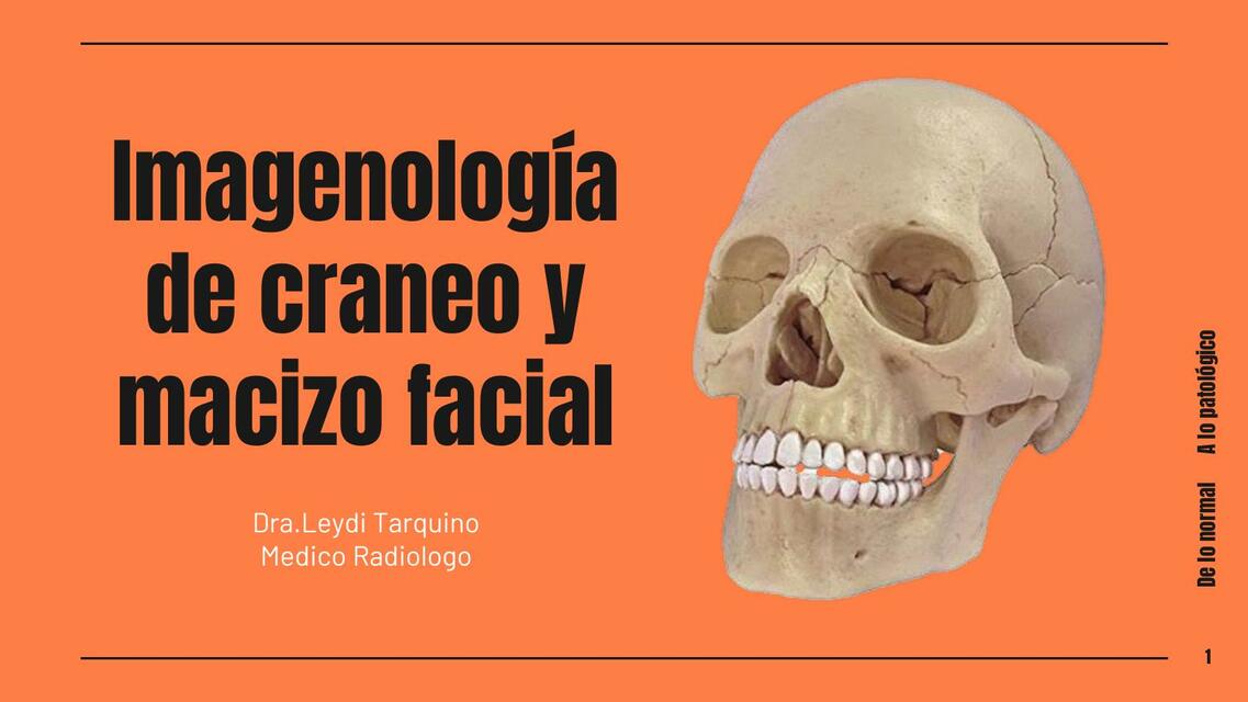 Imagenología de Cráneo y Macizo Facial | JOSE ALEJANDRO BUSTILLOS ARZE ...