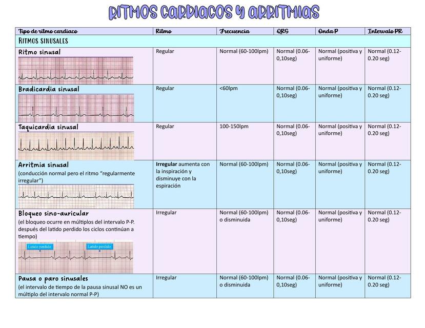 Ritmos cardiacos y arritmias | Medi_Hami | uDocz