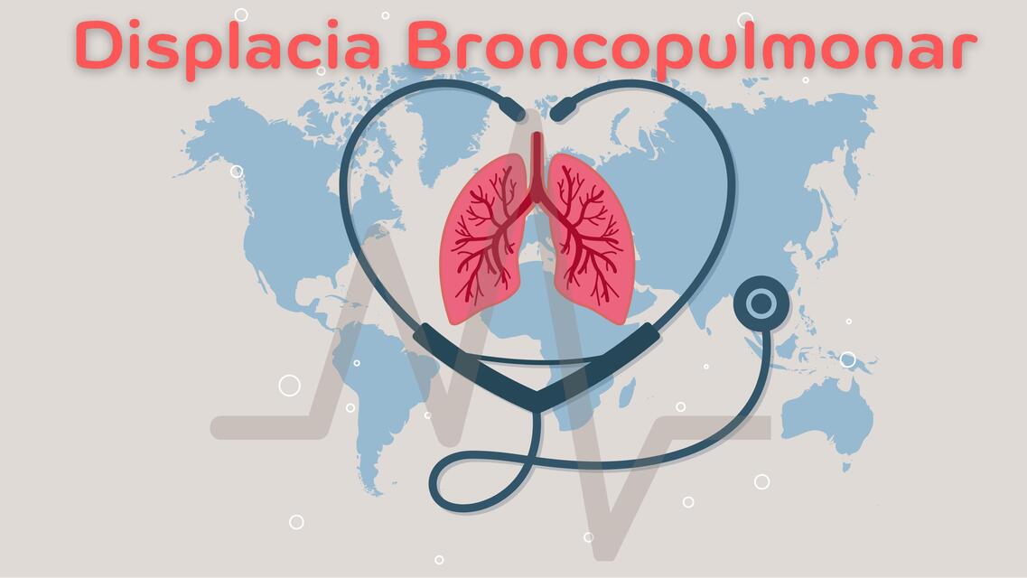 Displasia Broncopulmonar | daniel alexander neira mendoza | uDocz