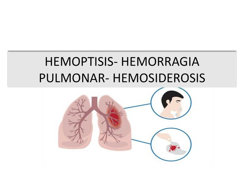 Hemoptisis | Dr gomez | uDocz